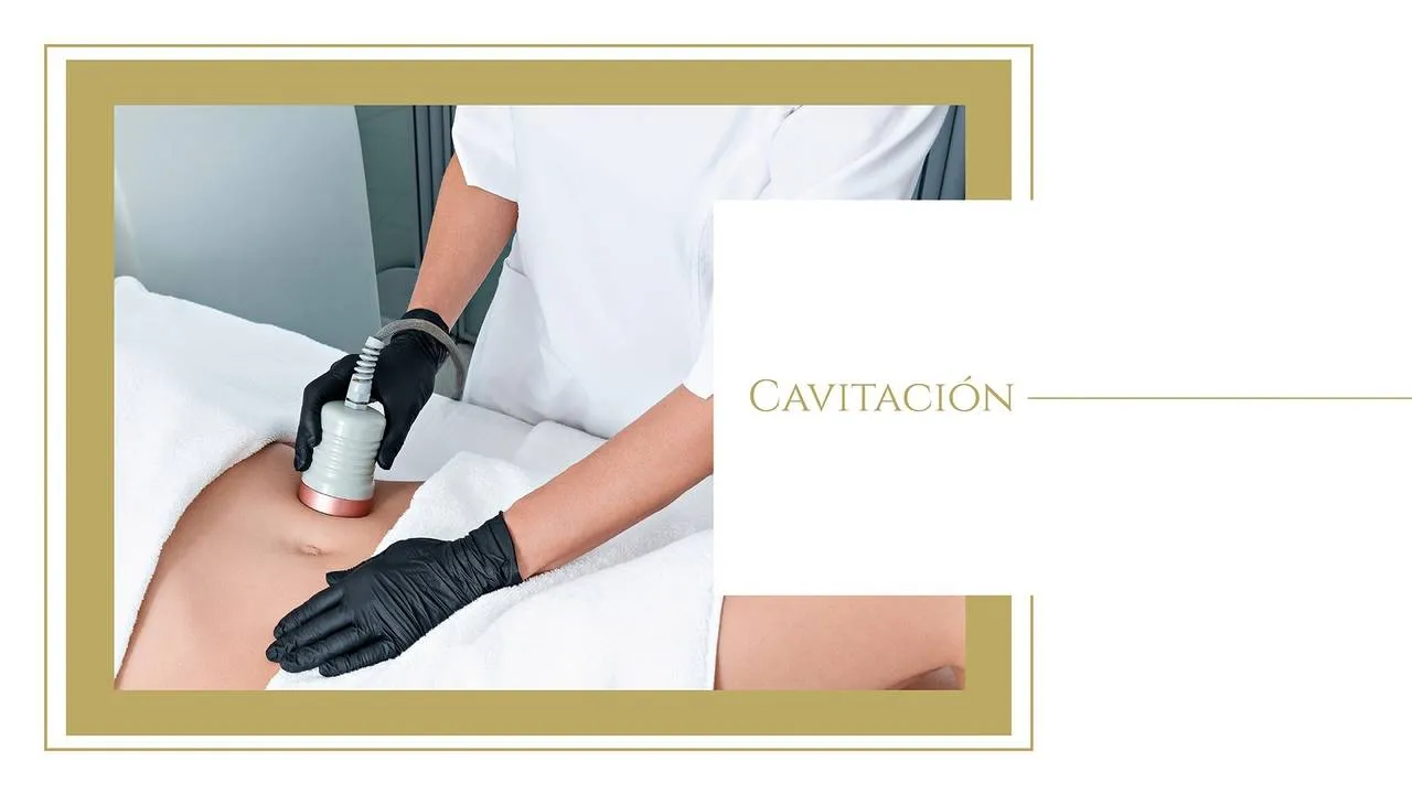 Cavitación - Cursos DNA Cavitación - Cursos DNA